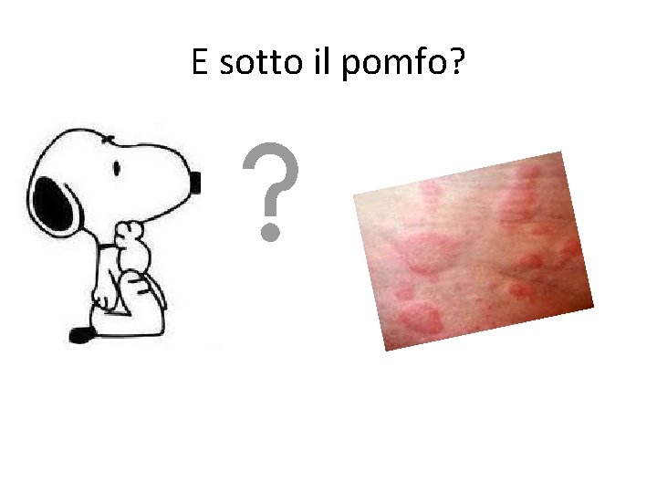 ORTICARIA MALATTIA ALLERGICA O AUTOIMMUNE Alberto Tedeschi Ambulatorio