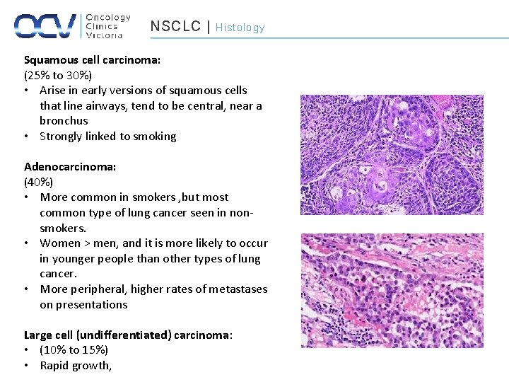 Treatment in Advanced NonSmall Cell Lung Cancer NSCLC