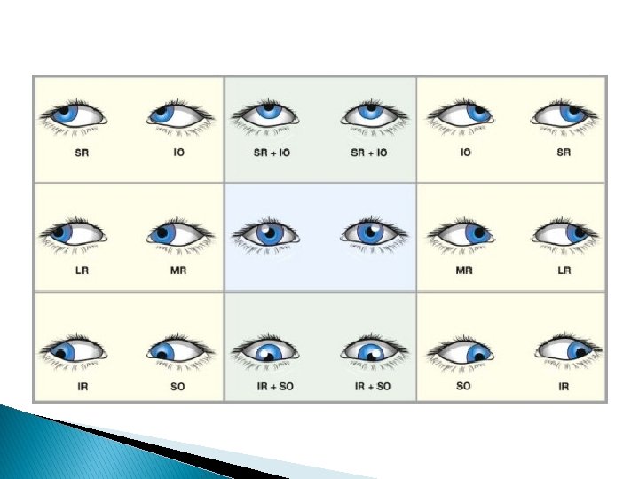 Strabismus The art of harmony Extraocular muscles Remember