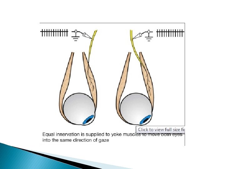 Strabismus The art of harmony Extraocular muscles Remember