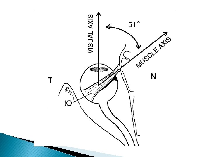 Strabismus The art of harmony Extraocular muscles Remember