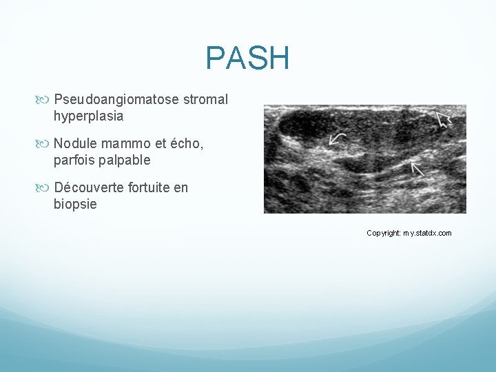 Les Lsions Bnignes du Sein Comment sy retrouver