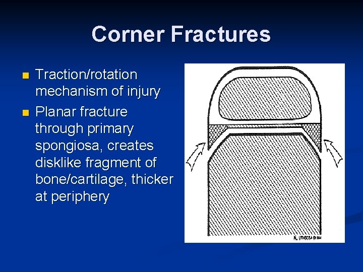 Orthopaedic Aspects of Child Abuse NAT Abdulaziz Alomar