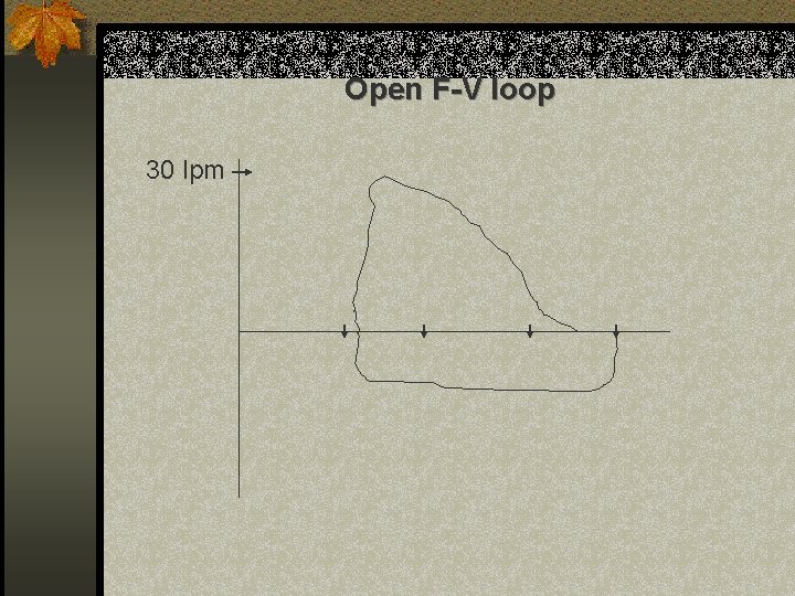 VENTILATOR GRAPHICS LOOPS AND CURVES dr r selvakumar
