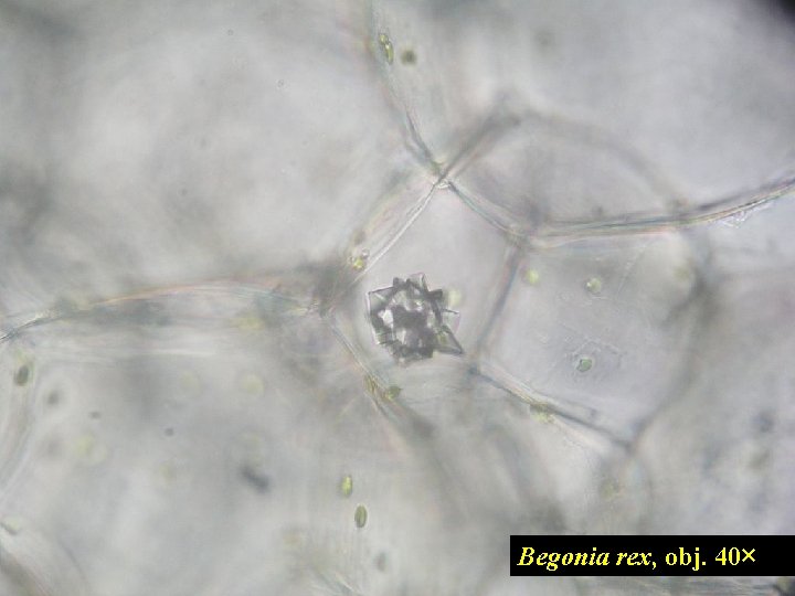 Cytologie II Bunn inkluze chromoplasty begnie kysala krlovsk