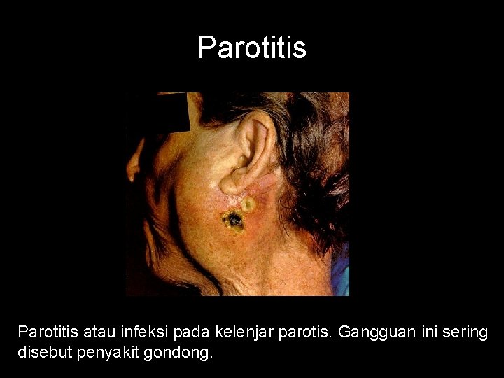 Sistem Pencernaan Makanan Gangguan Pada Sistem Pencernaan Anggota