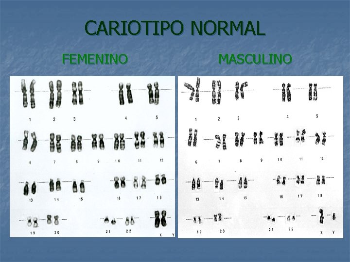 ANOMALAS DE LOS CROMOSMAS SEXUALES DETERMINACIN SEXUAL CONCEPTOS