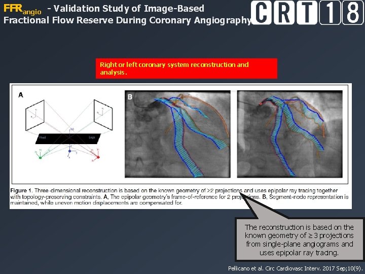Emerging FFR NonWireBased and QFR technology Hector M