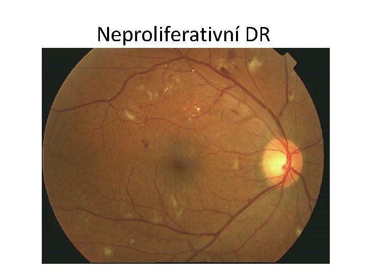 Oko a systmov choroby Spojivka Neinfekn znty spojivky