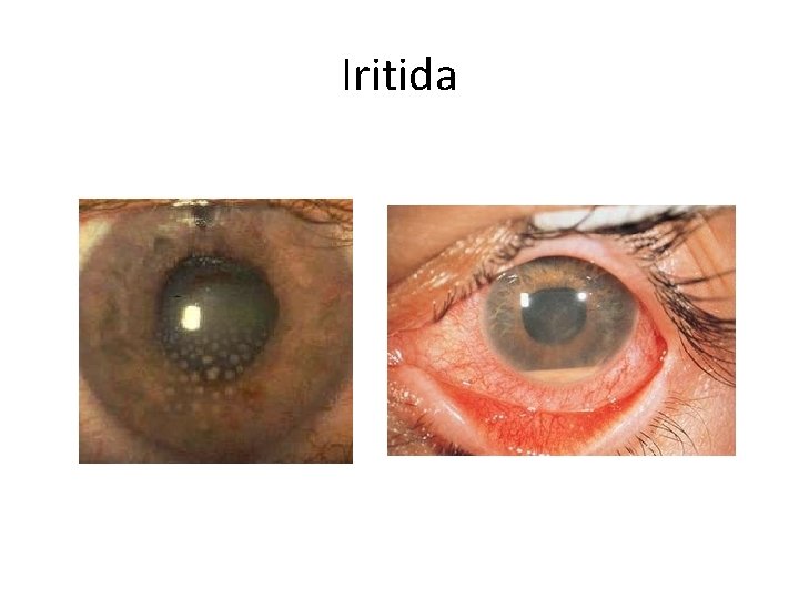 Oko a systmov choroby Spojivka Neinfekn znty spojivky