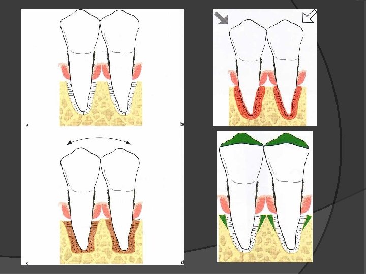 PERIODONTAL RESPONSE TO EXTERNAL FORCES Dr Mahdi Kadkhodazadeh