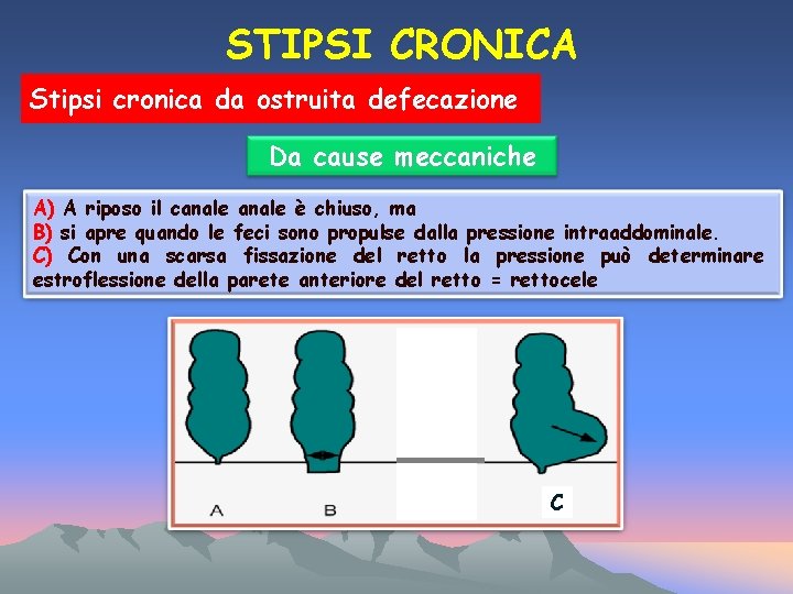 Fisiopatologia della Stipsi Cronica Pietro Dulbecco Universit degli