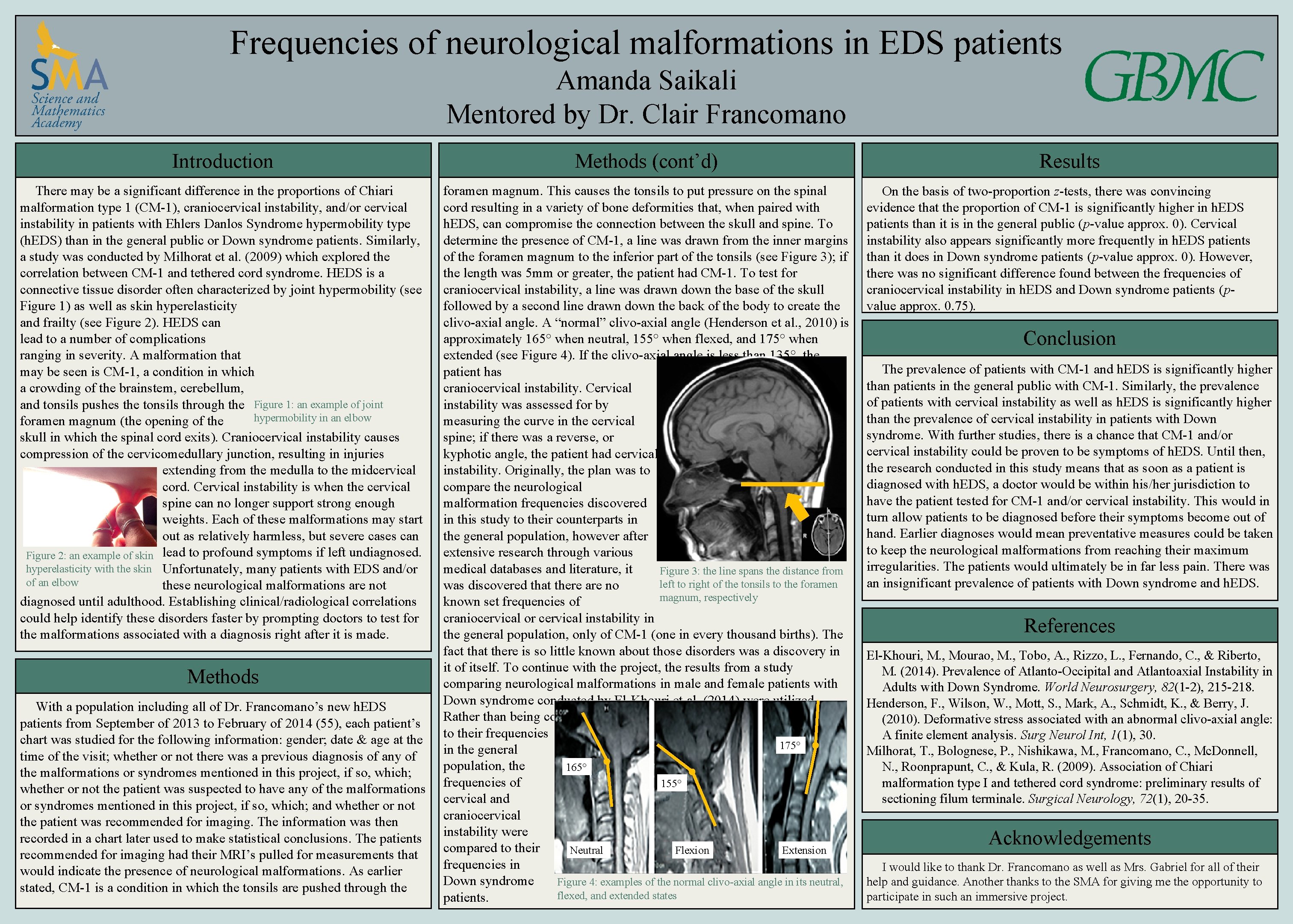 Frequencies of neurological malformations in EDS patients Amanda