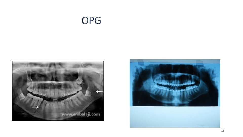 RADIOLOGICAL EXAMINATION 1 XRays Essential Routine Desirable Minimum