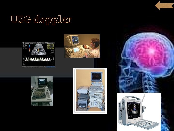 ultrasonografi Presentasi mengenai perkembangan teknologi informasi ...