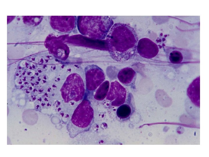 Protozoa Lab 14 Ciliates Balantidium coli Kinetoplastida 1