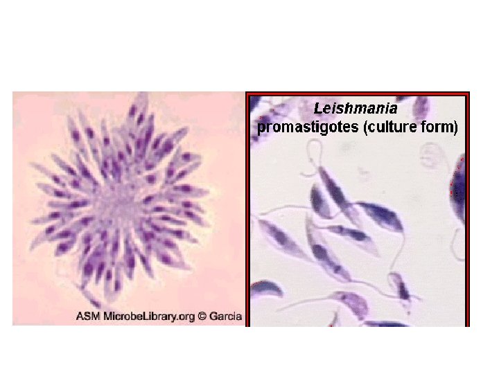 Protozoa Lab 14 Ciliates Balantidium coli Kinetoplastida 1