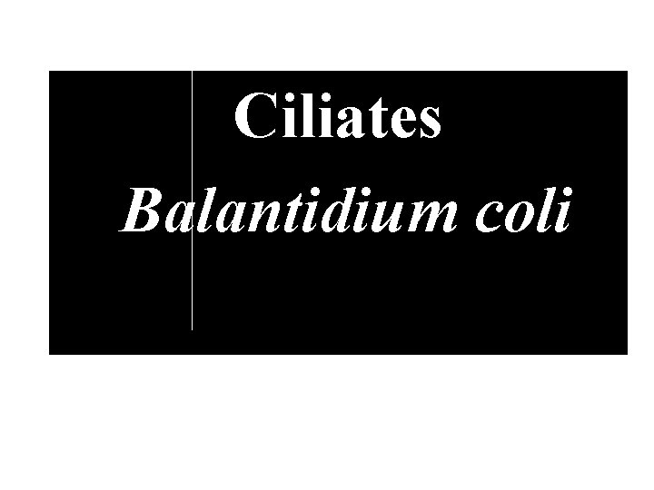Protozoa Lab 14 Ciliates Balantidium coli Kinetoplastida 1