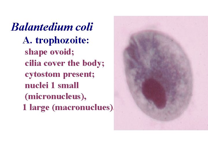 Protozoa Lab 14 Ciliates Balantidium coli Kinetoplastida 1