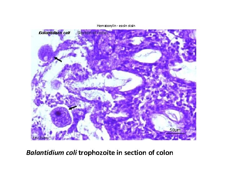 Protozoa Lab 14 Ciliates Balantidium coli Kinetoplastida 1