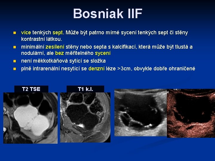 10 Valtick kurzy abdominln radiologie Cystick lze ledvin