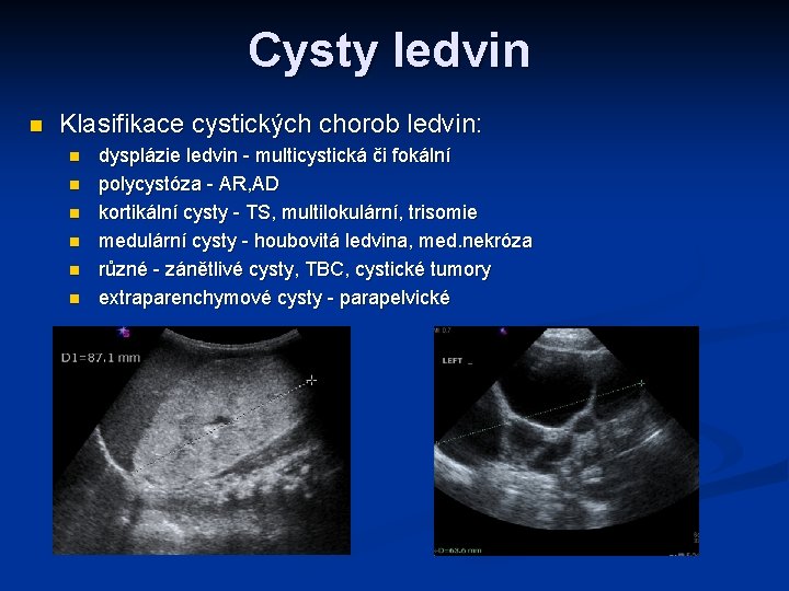 10 Valtick kurzy abdominln radiologie Cystick lze ledvin