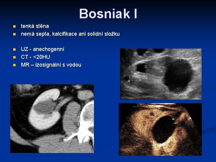 10 Valtick kurzy abdominln radiologie Cystick lze ledvin