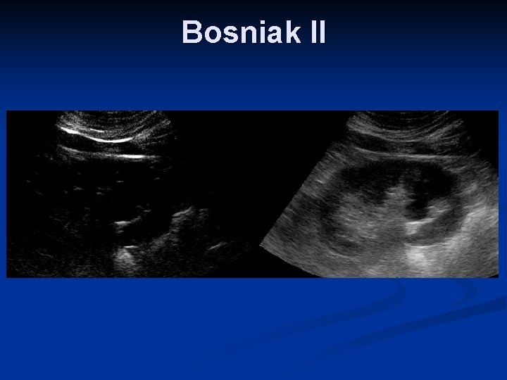 10 Valtick kurzy abdominln radiologie Cystick lze ledvin