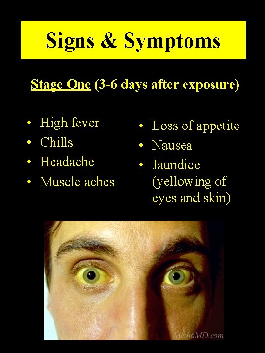 What is yellow fever A tropical disease that