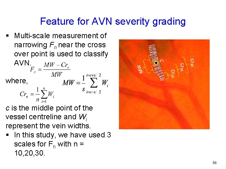 Large Analysis of microvascular lesions in the brain
