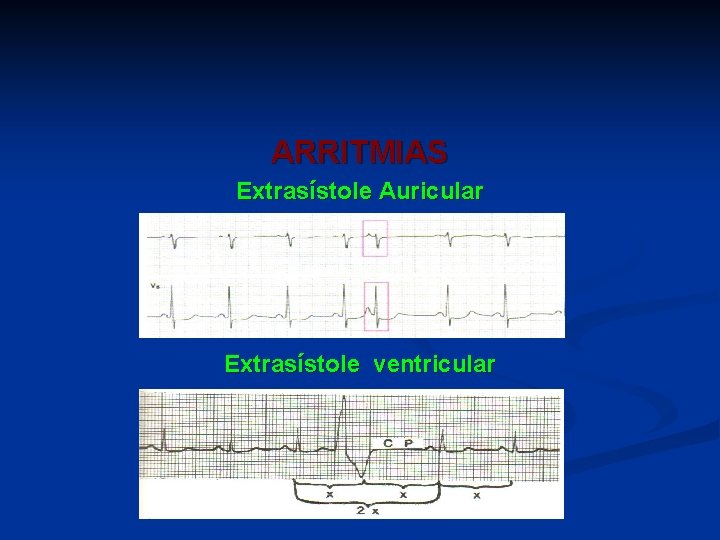 CURSO TALLER DE ELECTROCARDIOGRAFIA A R R I