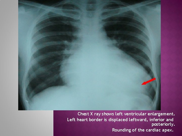 CARDIAC XRAY PRESENTED BY DR SANDEEP R 1