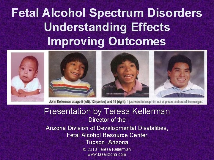 Fetal Alcohol Spectrum Disorders Understanding Effects Improving Outcomes