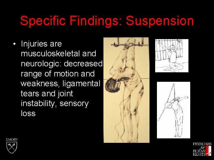Physical Exam in Survivors of Torture Laurie Bay