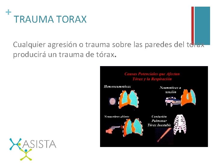 TRAUMA TORAX TRAUMA TORAX Cualquier agresin o trauma