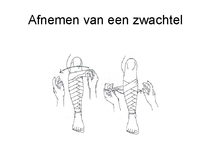 De verbanden Doel van een verband Opslorpen van