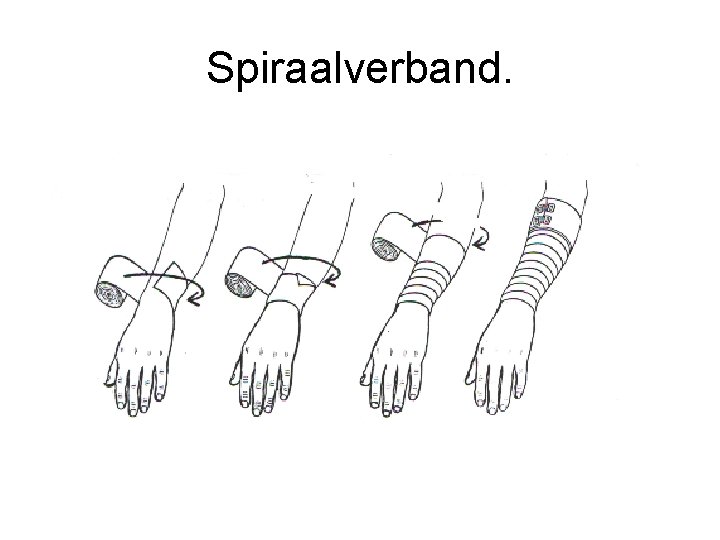 De verbanden Doel van een verband Opslorpen van