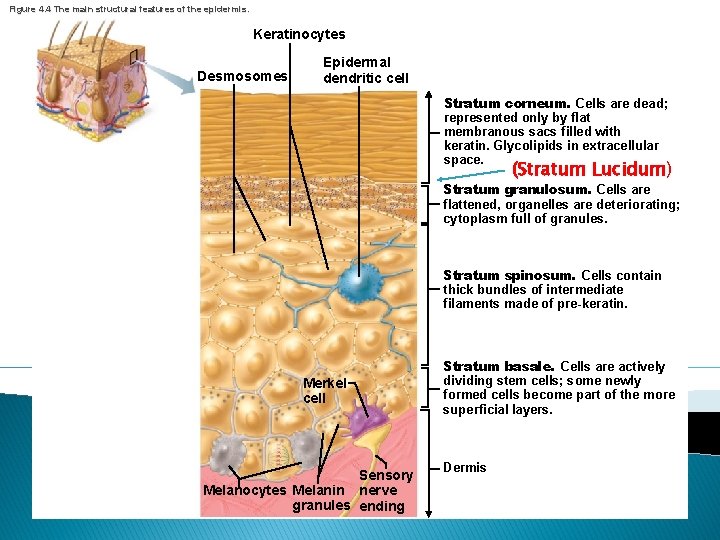 Chapter 4 Skin and Body Membranes Lecture Presentation