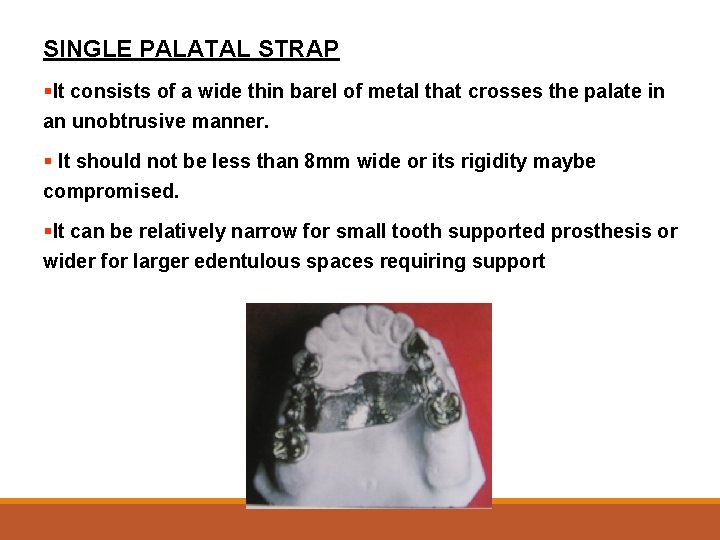 Major Connectors Components of a typical removable partial