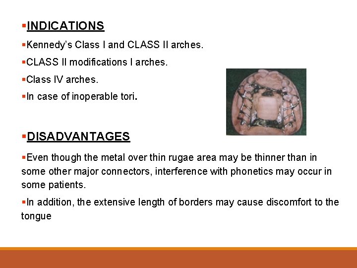 Major Connectors Components of a typical removable partial