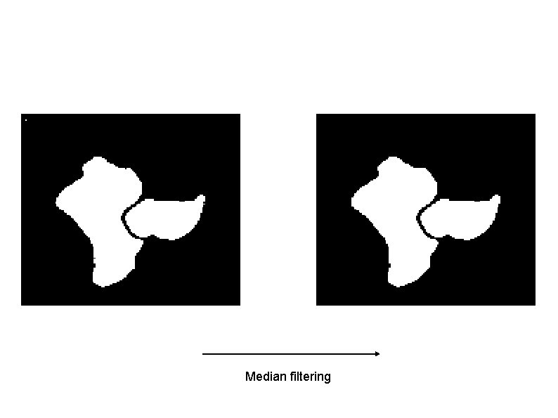 ENGN 2500 Medical Image Analysis Project Final Presentation