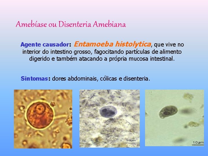 Amebase ou Disenteria Amebiana Agente causador Entamoeba histolytica