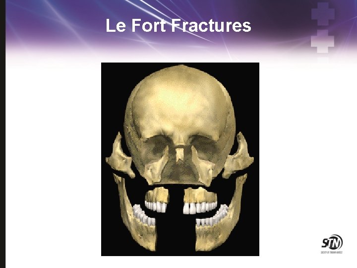 Maxillofacial and Ocular Injuries Objectives At the conclusion