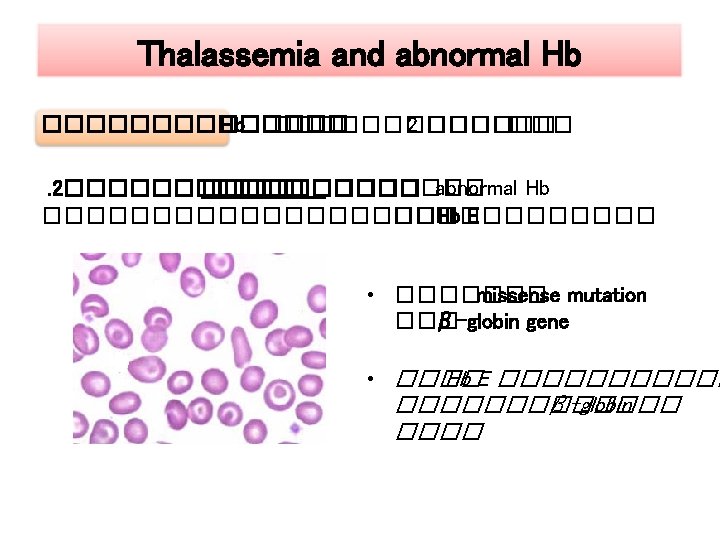 Thalassemia screening test Pichanee Chaweekulrat MD Lab Thalassemia