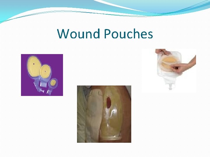Drains Ostomies and Wound Products By Mark Vance