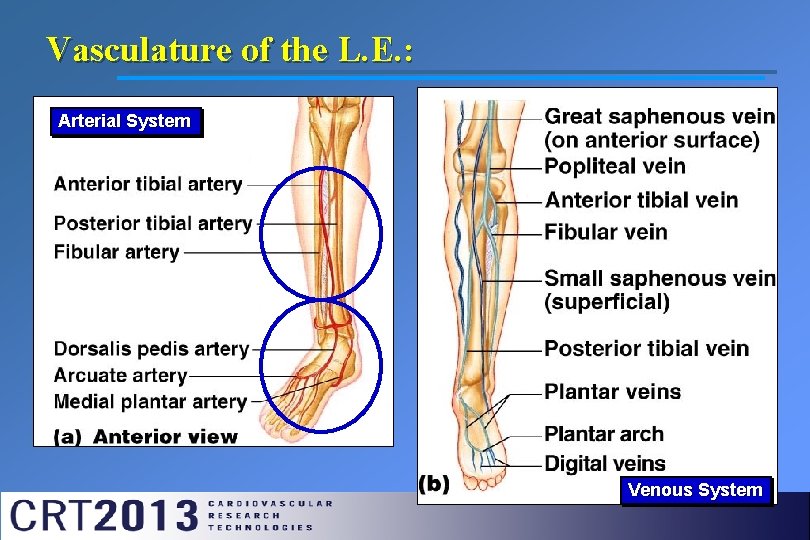 Peripheral Arterial Disease Critical Limb Ischemia Pedal Approach