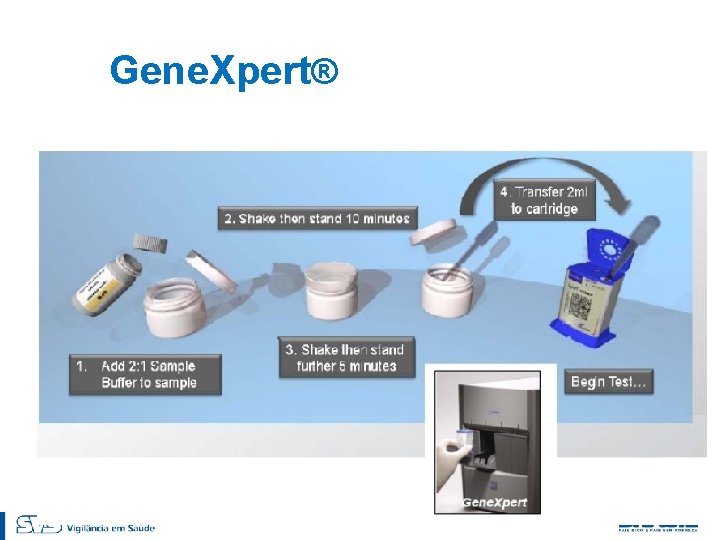 A nova tecnologia Gene Xpert e seu impacto
