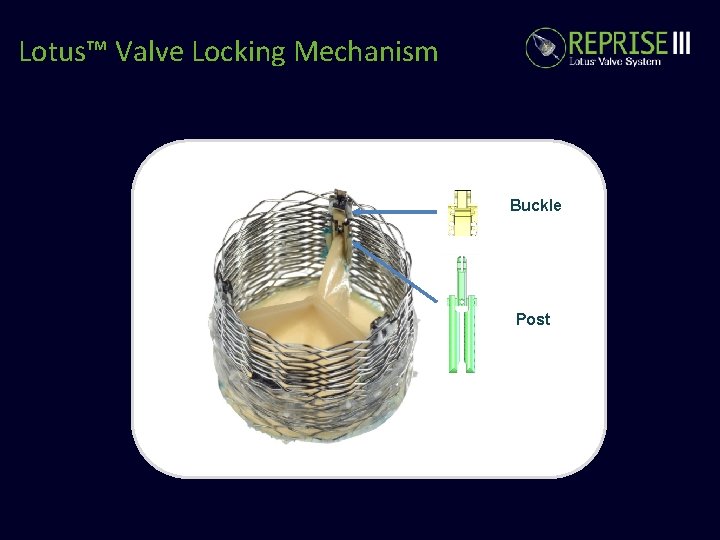 The Lotus Device Design and FirstinMan Experiences with
