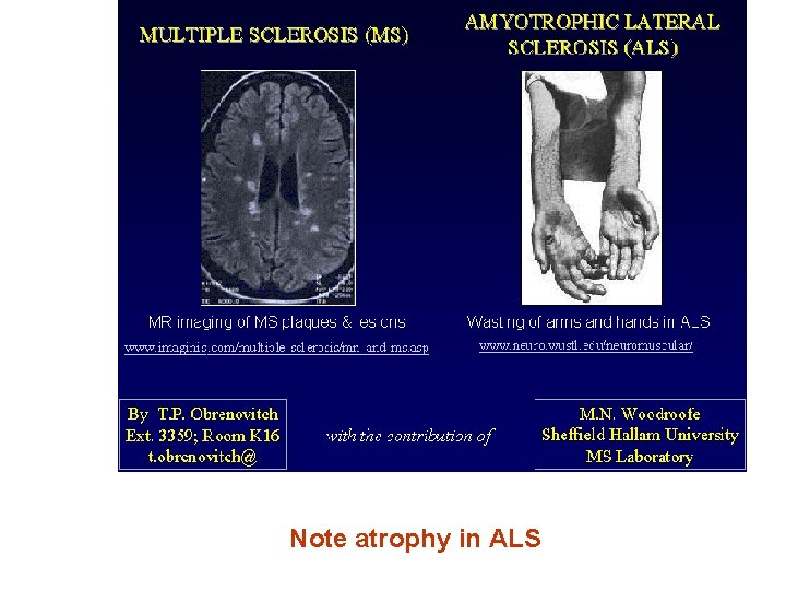 The image above illustrates an NADHTR stain showing