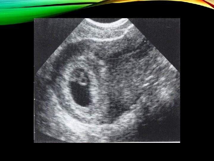 Selamat pagi PEMANTAUAN KESEJAHTERAAN JANIN ANTENATAL SEBAB KEMATIAN